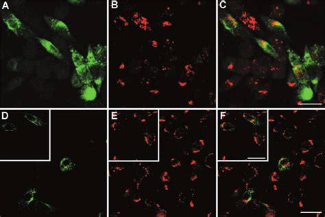Golgi And Trans Golgi Network Tgn Markers Do Not Have Subcellular Download Scientific Diagram