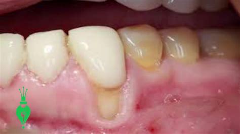 АМНЫ ЭВГҮЙ ҮНЭР БУЙЛНЫ ҮРЭВСЛЭЭС ҮҮДЭЛТЭЙ БУЙЛНЫ ҮРЭВСЭЛ МАШ ОЛОН ХАВДРЫН ЭХ ҮҮСВЭР БОЛДОГ Youtube