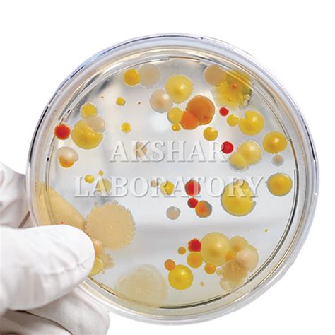 Bacillus Anthracis Testing Services At Best Price In Ahmedabad Akshar Analytical Laboratory