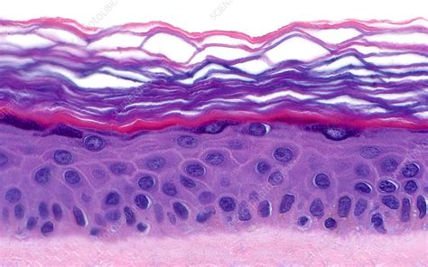 Skin Epidermis Light Micrograph Stock Image C059 0863 Science Photo Library