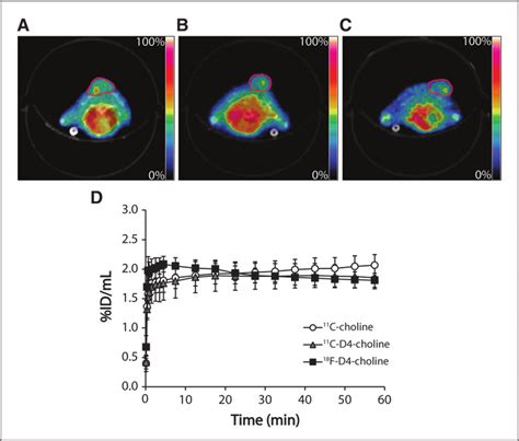 11 C Choline 11 C D4 Choline ~ And 18 F D4 Choline And Pet