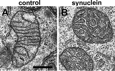 α Synuclein At The Mitochondrial Membrane Prelude To A Kill♦ Journal