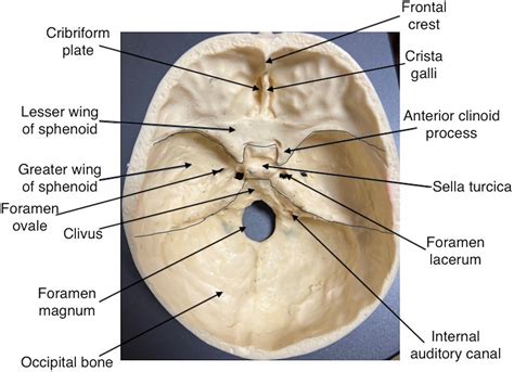 Dorsum Sellae Skull