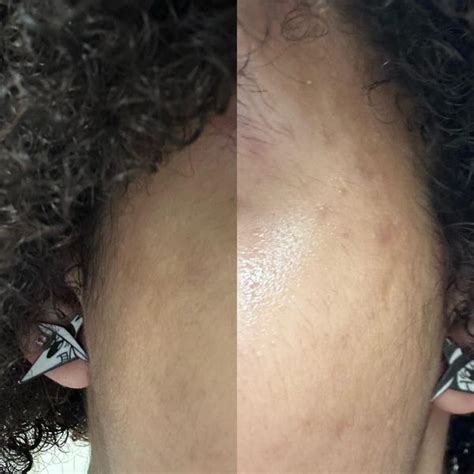 Yung Lean Arizona Iced Tea Set Of Pins Unknown Death 2002 Sad Boys