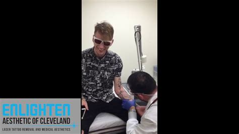 Mgk Laser Tattoo Removal At Enlighten Aesthetic Laser Tattoo Removal