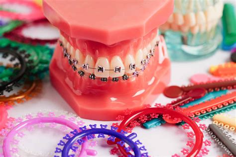 Orthodontic Information Fort Collins And Loveland Co