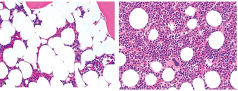 Pathophysiology Cell Injury Cell Death And Adaptation Flashcards