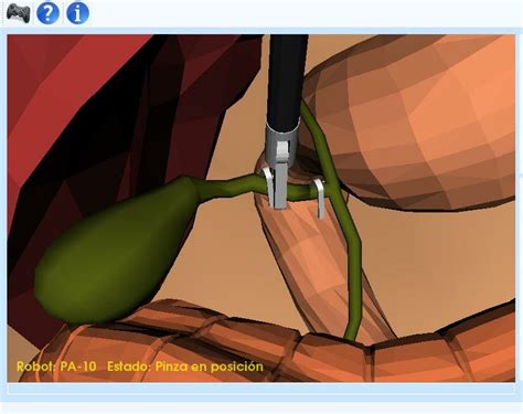 Clips Placed In The Cystic Duct Source Authors C Gallbladder Download Scientific Diagram