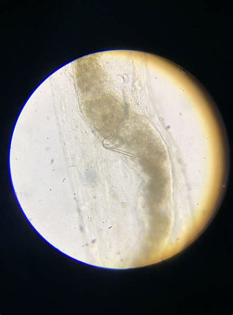 Think My Fish Have Roundworms Treating With Prazipro The Planted