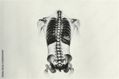 Illustration Stock X Ray Showing The Human Spine Structure Shown Together With The Human Body