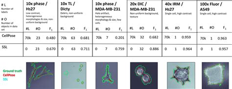 Segmentation Evaluation Of Self Supervised Machine Learning Ssl And