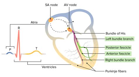 Bundle Branch And Fascicular Blocks Concise Medical Knowledge