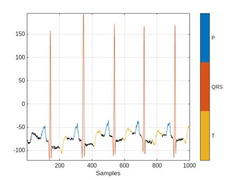 Create Labeled Signal Sets Iteratively With Reduced Human Effort MATLAB Simulink