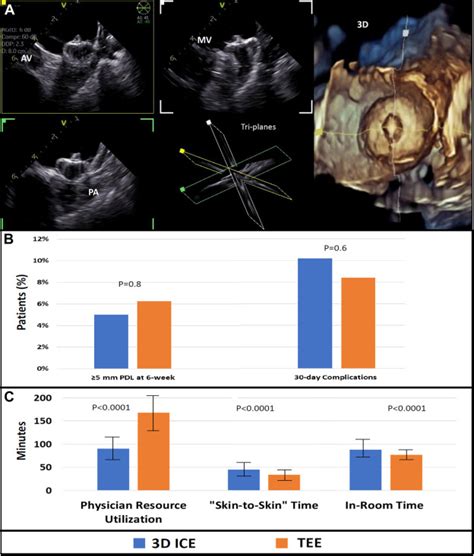 Comparison Of Left Atrial Appendage Occlusion Using Transesophageal
