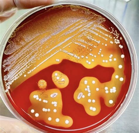 Staphylococcus Capitis On Columbia Blood Agar Rmicrobiologyobsession