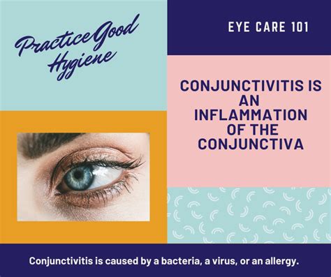 Memes Conjunctivitis
