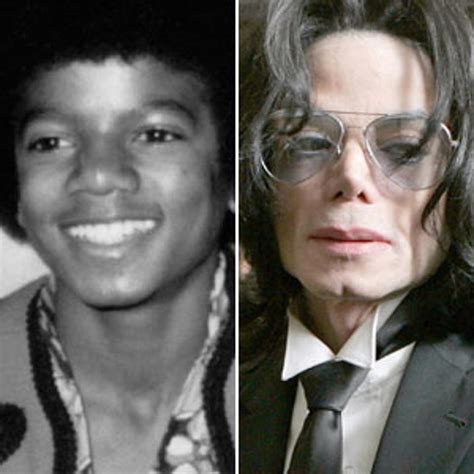 Michael Jackson After Plastic Surgery
