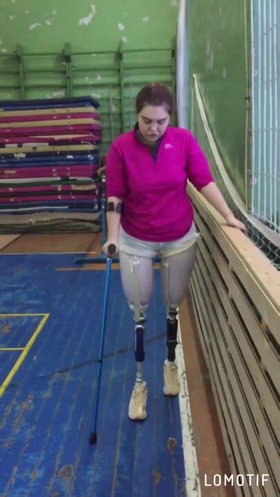 Woman With Double Leg Amputation