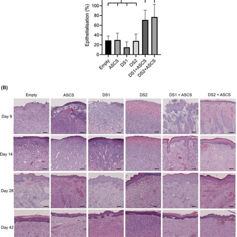 Percent Epithelialisation Was Quantified Histomorphometrically And