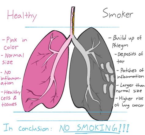 Healthy Vs Smokers Lungs Understanding Lung Anatomy Basics Colorful
