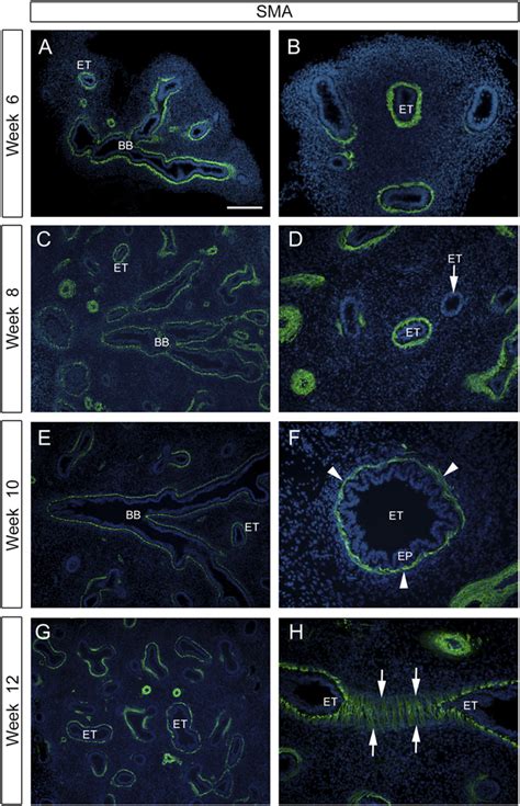 Smooth Muscle Actin Sma Immunostaining Of Human Lung Sections From