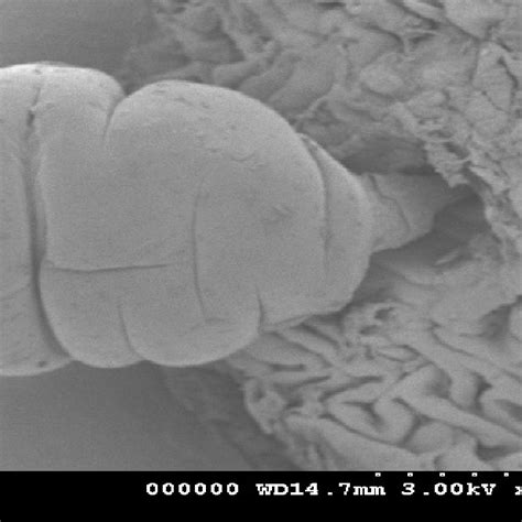 Normal Intestinal Villi Of A Hill Stream Fish Schizothorax Download