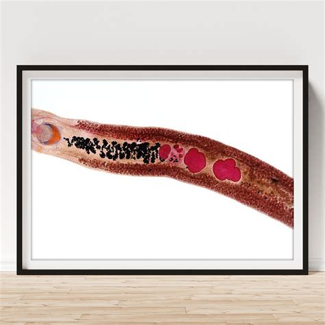 Fluke Worm Light Micrograph 2 Poster By Science Photo Library