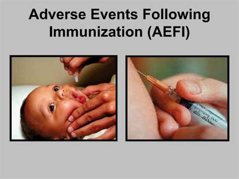 Aefi Immunization Basics Ppt