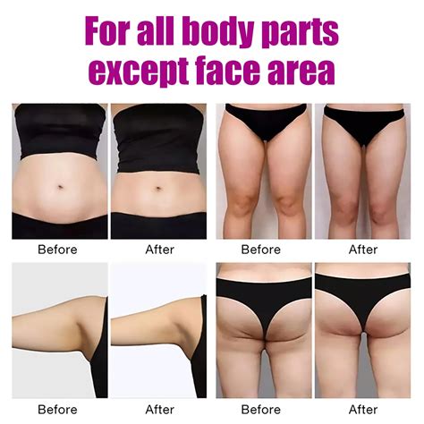 Slimming Wormwood Waist Paste Medicine Patch For Fat People Diet