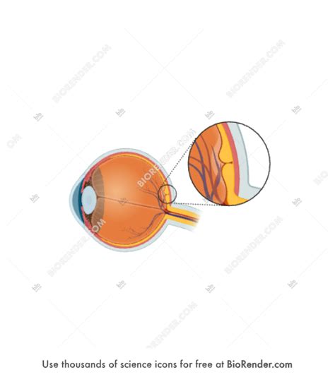Free Eye Sagittal Macular Edema Zoom Icons Symbols And Images