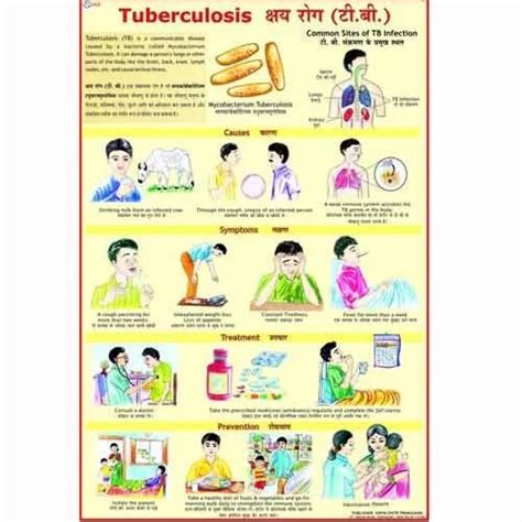 Common Diseases And Their Prevention Tuberculosis Charts Manufacturer