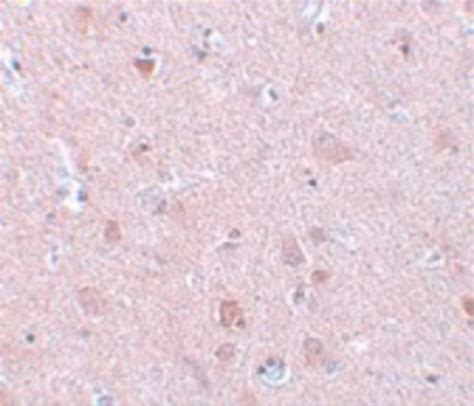 Efhd2 Antibody Cat No 5657 Prosci