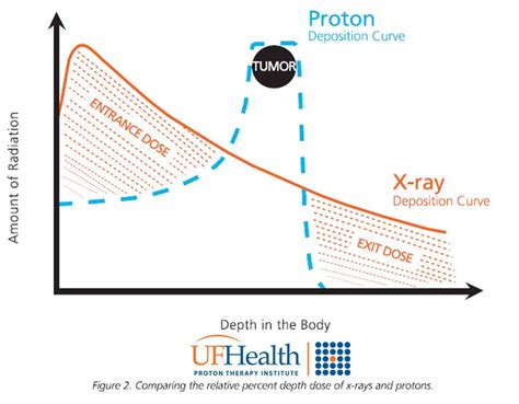 Radiation Treatment For Prostate Cancer With Proton Therapy The Uf