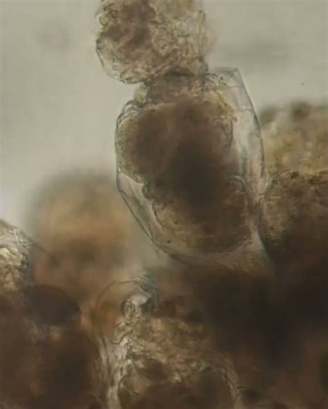 Rotifers Maybe Conochilus Sp Youtube