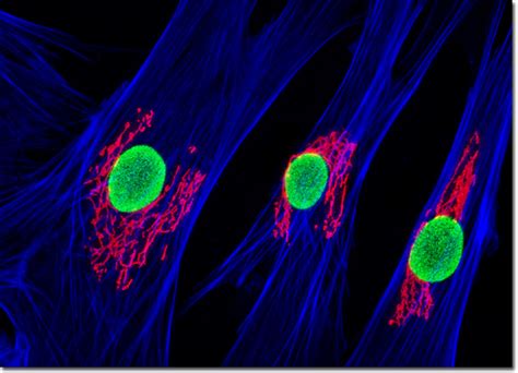 Molecular Expressions Microscopy Primer Specialized Microscopy