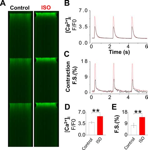 Response To Beta Adrenergic Stimulation Of Cardiomyocytes From