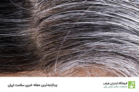 کمبود این ویتامین باعث سفید شدن مو می‌شود