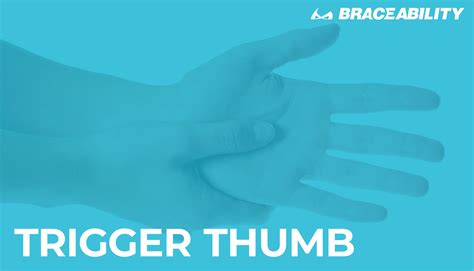 Trigger Thumb 101 Treatment Symptoms Causes And Surgery Info