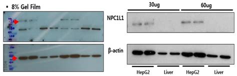 Figure 2 From Effect Of Ezetimibe On Hepatic Adipose Tissue Glucose Metabolism And