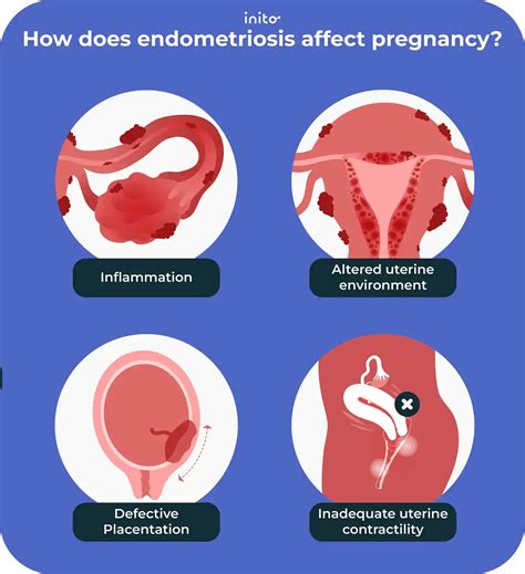 Getting Pregnant With Endometriosis Success Stories