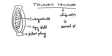 Solved Urgent Thanks 2 A Patient Was Diagnosed As Having Rectal Prolapse A Sketch The Ovum Of