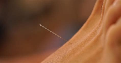 Science Of Acupuncture Delcollo Acupuncture