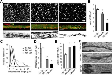 Mitochondrial Fragmentation Is Associated With Axonal Degeneration