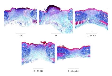 Massons Trichrome Staining Of Collagen Blue Green In The Healing