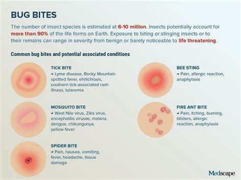Bug Bites Insect Species Bug Bites Life Form