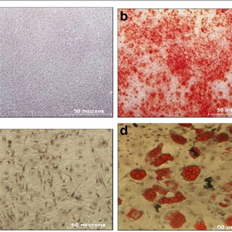 Intracellular Staining For Insulin Three Columns Show Insulin Staining Download Scientific