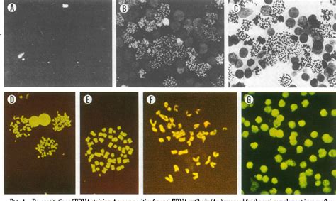 Figure 1 From Identification Of A Purified Complement Fixing Antigen As