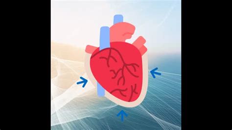 Acute Pericarditis Diagnosis Overview Youmedtube For Physicians