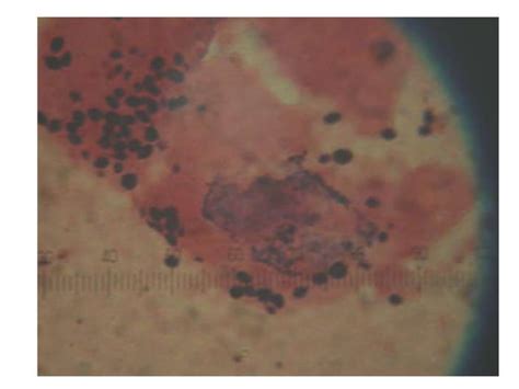 Cryptococcus Pptx Cryptococcus Pptx