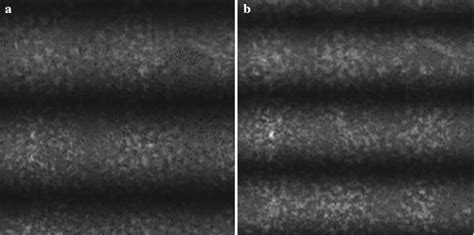 Carrier Fringe Patterns Of Field V A Before Deformation B After